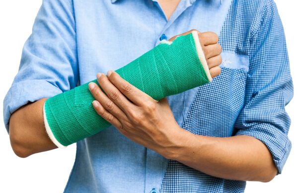 Plastični gips – šta je to i koje su prednosti - Dr Dren