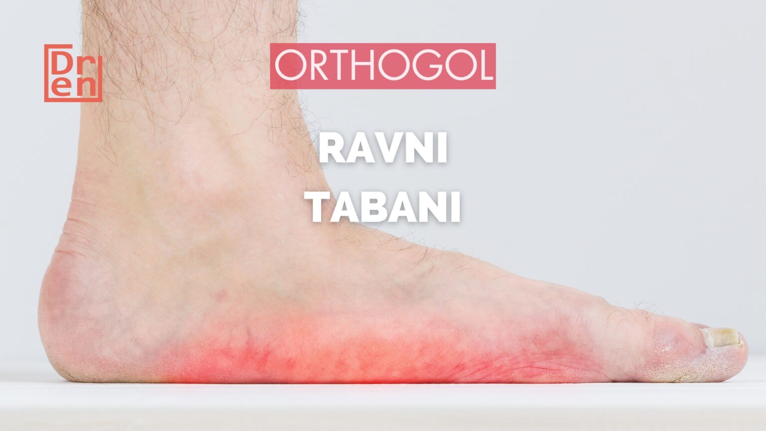 Ravni tabani i ravna stopala sve što treba da znamo- Dr Dren