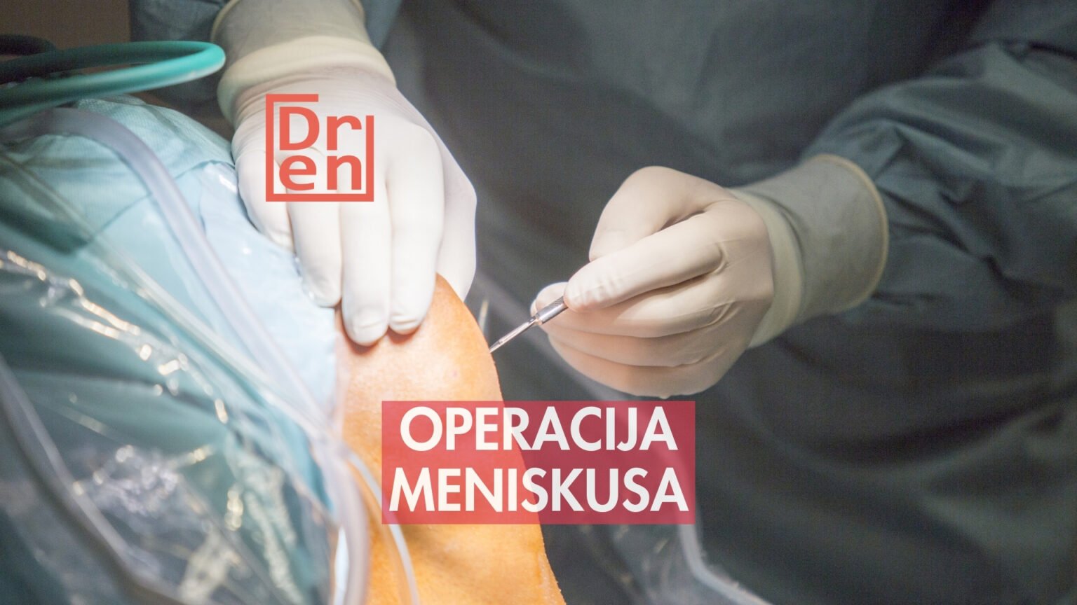 operacija meniskusa cena - Dr Dren