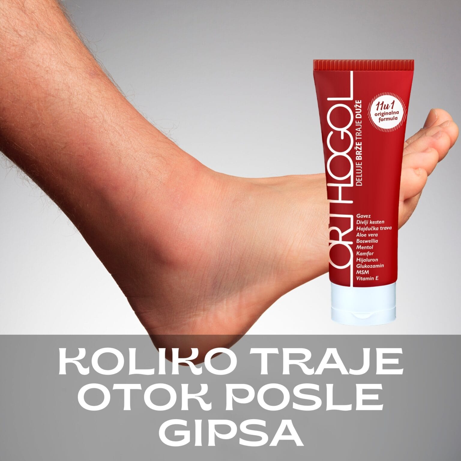 Koliko traje otok posle gipsa i kako smanjiti otok posle skidanja gipsa